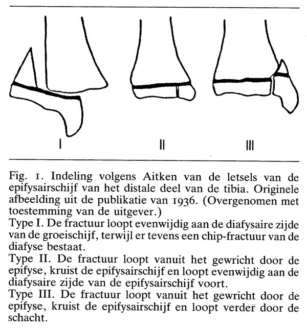 Epifysiolysefracturen van het distale deel van de tibia | NTVG