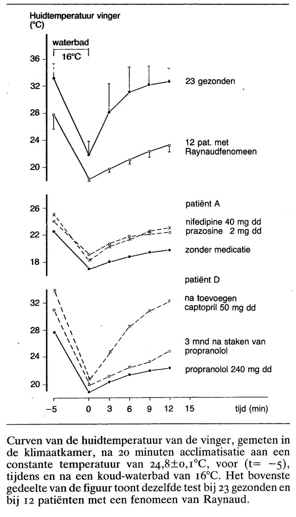 Differentiaaldiagnostische overwegingen bij het fenomeen van Raynaud ...