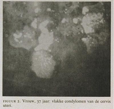 Nederlandse Vereniging voor Dermatologie en Venereologie | Nederlands ...