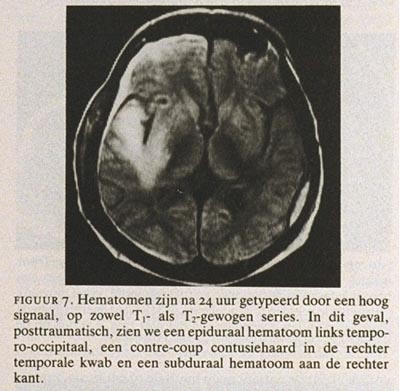 Kernspinresonantietomografie; een jaar ervaring | Nederlands ...