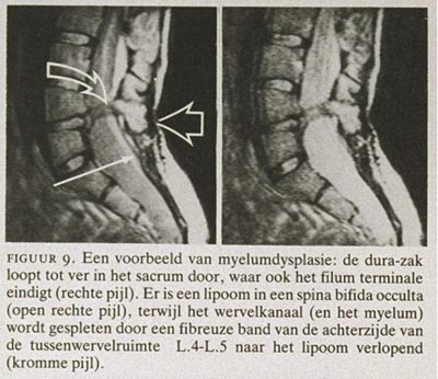 Kernspinresonantietomografie; een jaar ervaring | Nederlands ...
