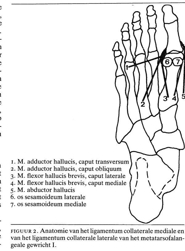Operatie van hallux valgus wegens varusstand van het os metatarsale I ...