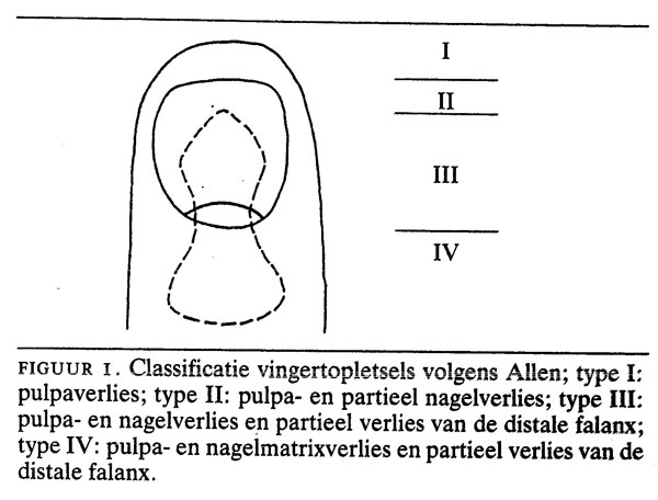 Behandeling van vingertopletsels met zilversulfadiazine | Nederlands ...