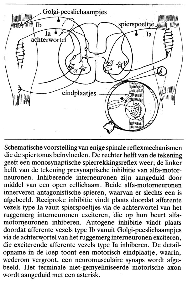 Spierkramp; een pijnlijk probleem | NTVG