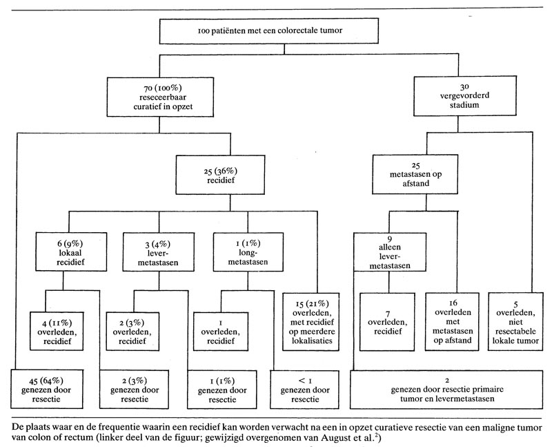 Consensus follow-up-onderzoek na operatie wegens colon- of ...