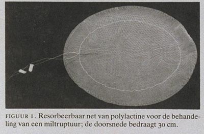 Een sparende methode bij miltruptuur door toepassing van een ...