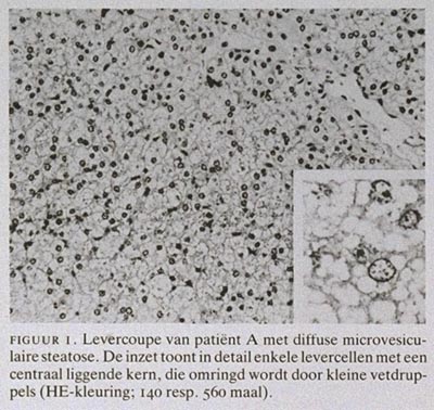 Twee patiënten met het syndroom van Reye? | NTvG