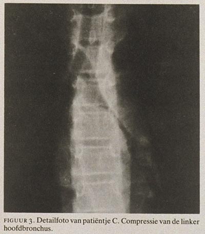 'Typisch atypisch' | Nederlands Tijdschrift voor Geneeskunde