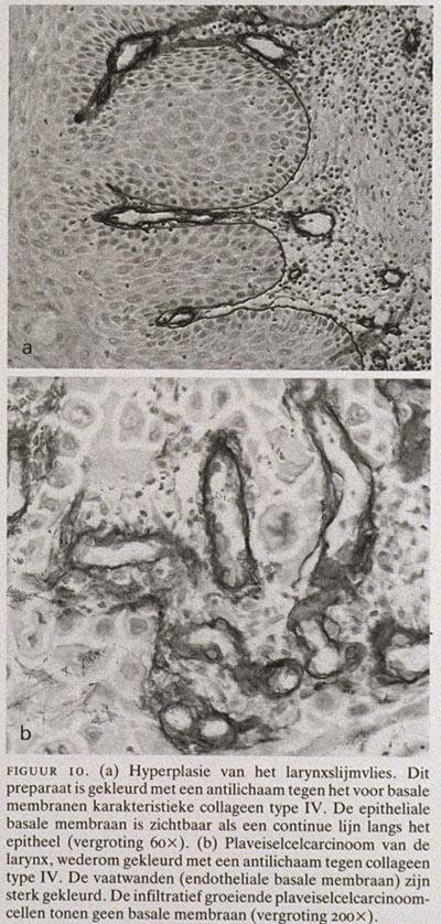 Nieuwe methoden in de pathologische anatomie | Nederlands Tijdschrift ...