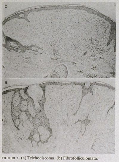 Nederlandse Vereniging voor Dermatologie en Venereologie | NTvG