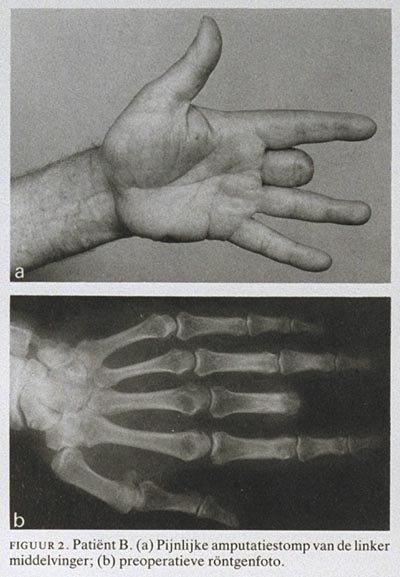 De handversmalling | NTVG