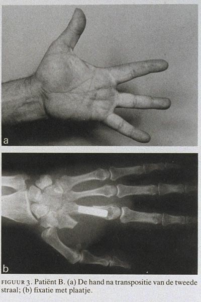 De handversmalling | NTVG