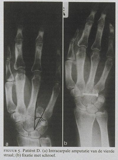 De handversmalling | NTVG