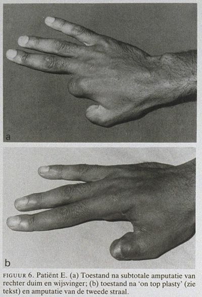 De handversmalling | NTVG