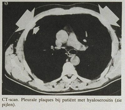 Nederlandse Vereniging voor Radiodiagnostiek | Nederlands Tijdschrift ...