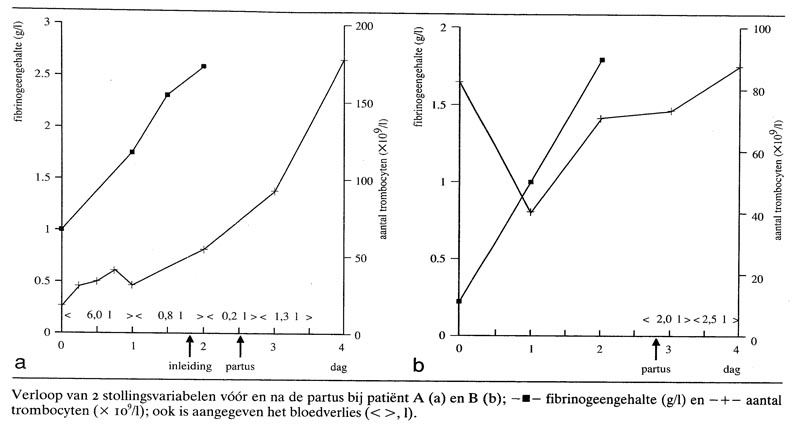 Solutio placentae en stollingsstoornissen | Nederlands Tijdschrift voor ...