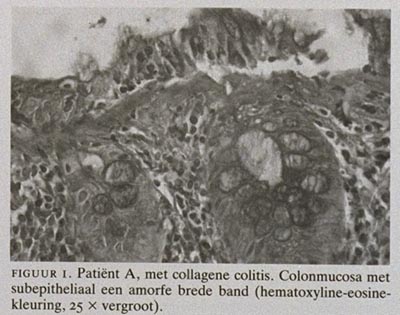 Collagene colitis; een onzichtbare aandoening? | NTVG