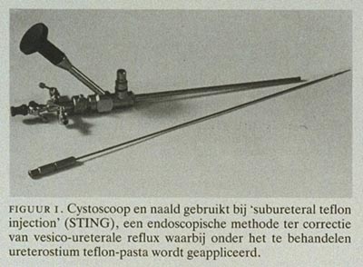 De 'STING'-procedure: subureterale teflon-applicatie bij vesico ...
