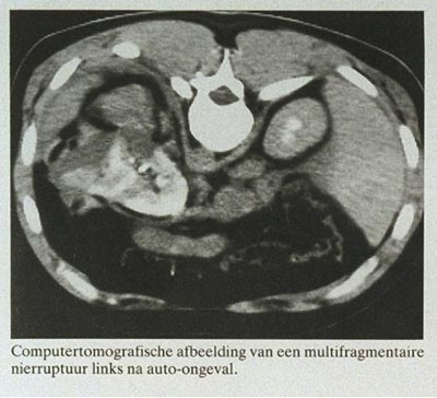 Nederlandse Vereniging voor Radiodiagnostiek | Nederlands Tijdschrift ...