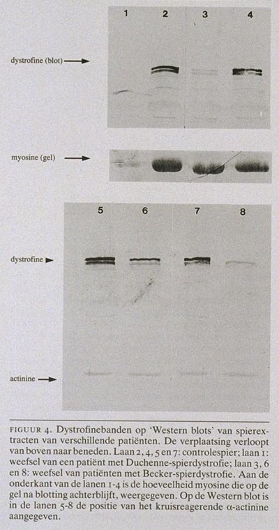 Toepassing van gecombineerde DNA- en dystrofine-eiwitanalyse in de ...