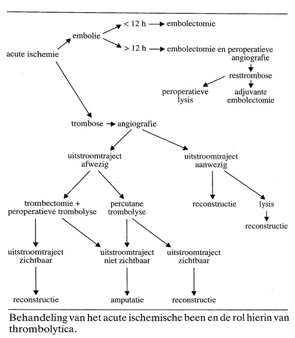 Trombolyse van beenslagaderen | Nederlands Tijdschrift voor Geneeskunde