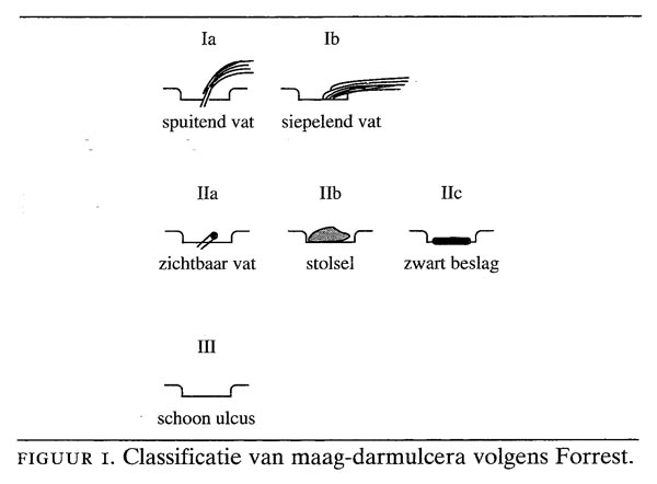 Bloedingen hoog in de tractus digestivus; een inventarisatie in de ...