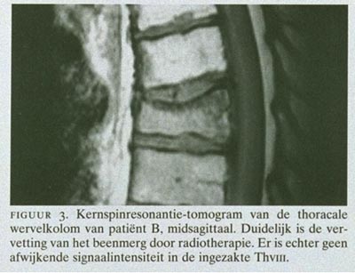 Botpijnen bij patiënten met kanker berusten niet altijd op ...