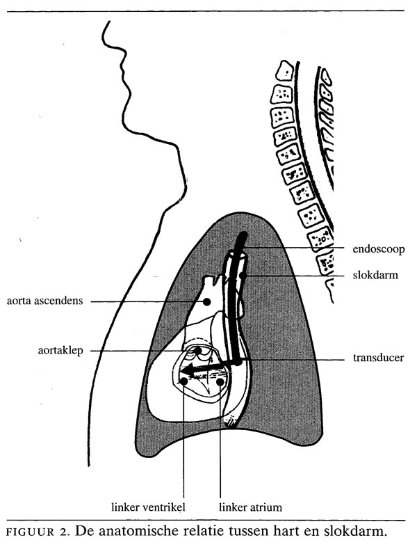 Slokdarm Reinier De Graaf Ziekenhuis Patiëntfolder: Dysfagie