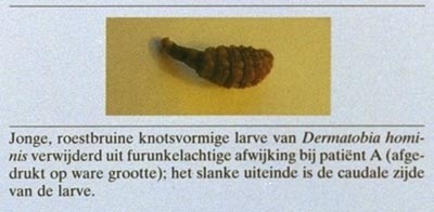 Larves De Dermatobia Hominis Myiasis Wikipedia