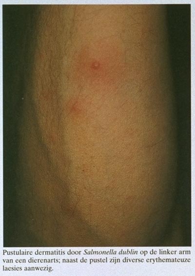 Pustulaire dermatitis bij dierenartsen na verlossingen van ...