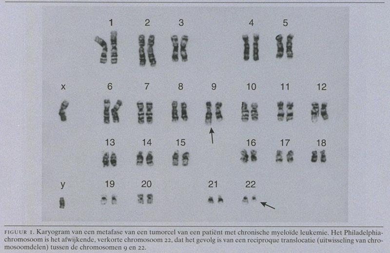 Ontwikkelingen in de behandeling van patiënten met chronische myeloïde ...