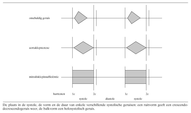 Het systolisch hartgeruis | NTVG