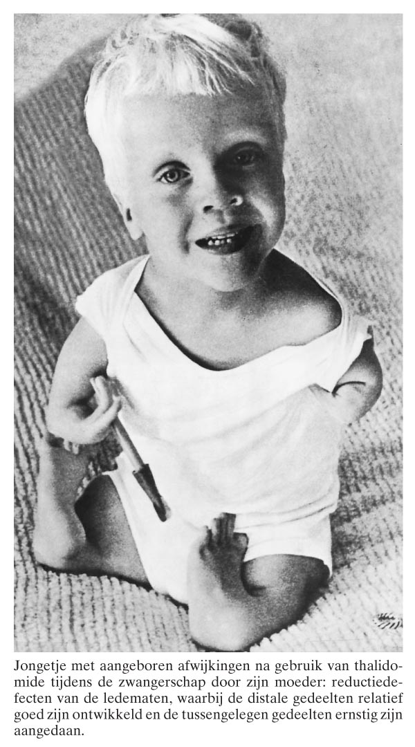 Thalidomide opnieuw in de belangstelling | Nederlands Tijdschrift voor ...