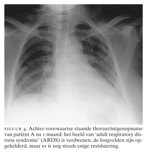 Een zeer ernstig beloop van psittacose in de zwangerschap | Nederlands ...