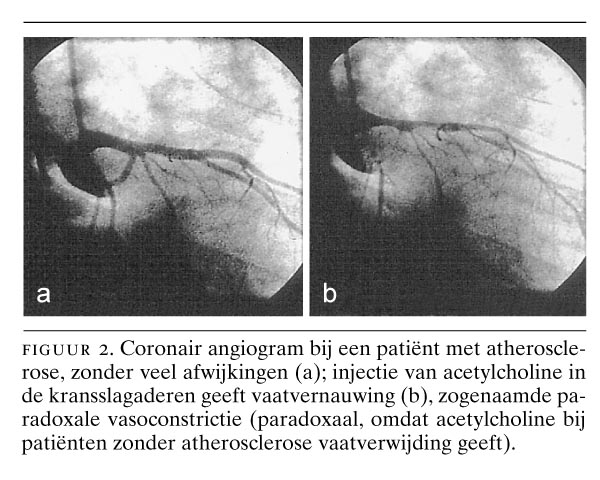 Nobelprijs Geneeskunde en Fysiologie 1998 vanwege de betekenis van ...