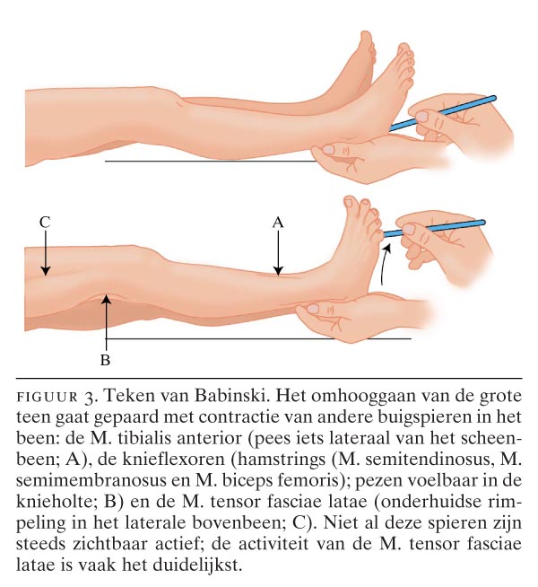 Fysische diagnostiek - de voetzoolreflex | Nederlands Tijdschrift voor ...