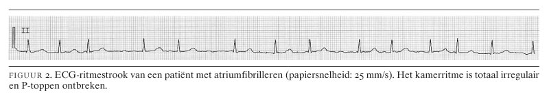 Elektrofysiologie van de atrioventriculaire knoop tijdens ...