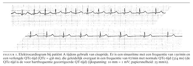 Verlenging van de QTc-tijd bij een pasgeborene tijdens gebruik van ...