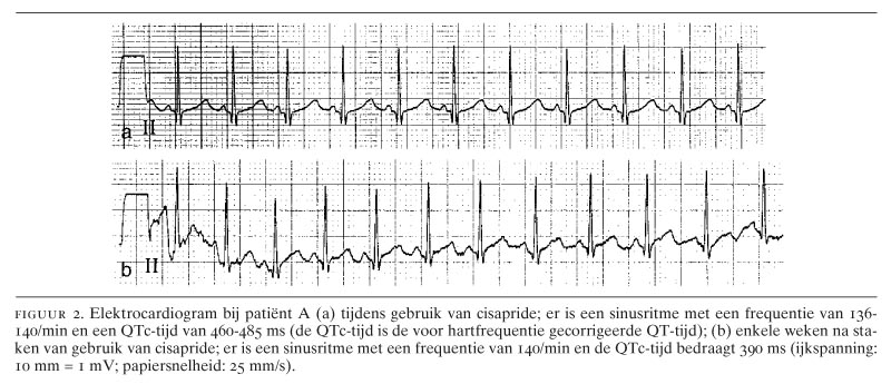 Verlenging van de QTc-tijd bij een pasgeborene tijdens gebruik van ...