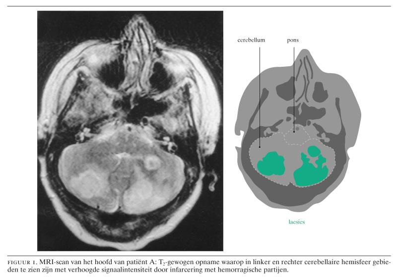 Klinisch denken en beslissen in de praktijk. Een oudere patiënte met ...