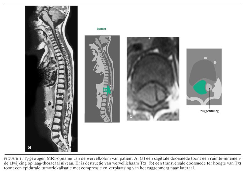 Ruggenmergdiagram Voor Kinderen Nu De Juf Op School Nog Meekrijgen