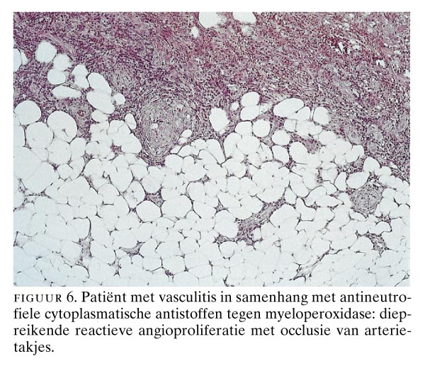 Nederlandse Vereniging voor Dermatologie en Venereologie | Nederlands ...