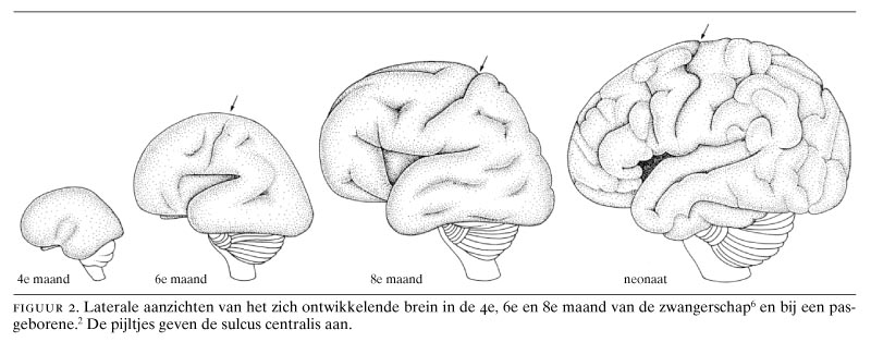 Ontwikkeling en ontwikkelingsstoornissen van het humane brein. II ...
