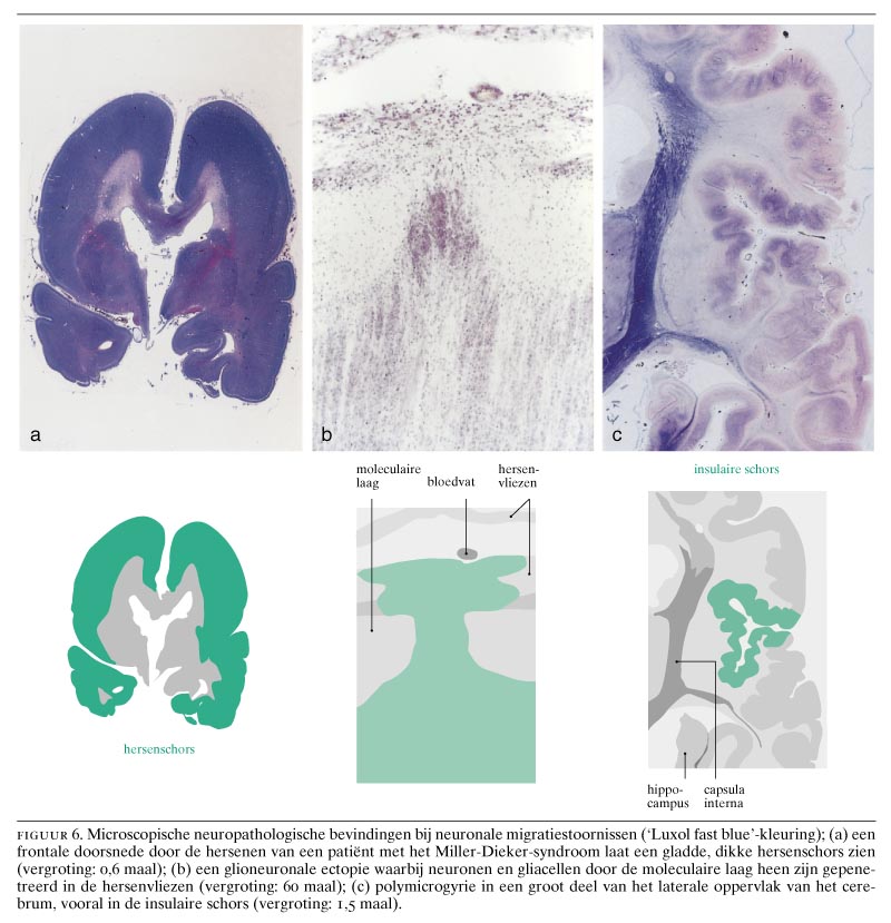 Ontwikkeling en ontwikkelingsstoornissen van het humane brein. III ...