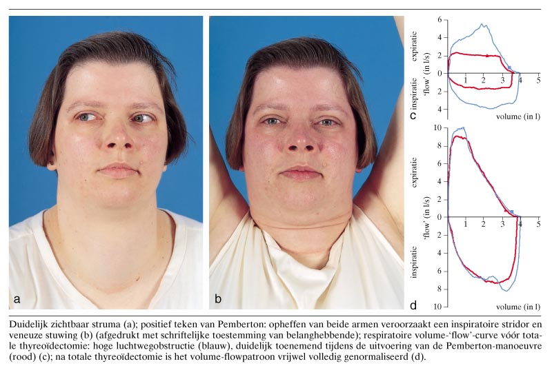 Diagnose in beeld (50) | Nederlands Tijdschrift voor Geneeskunde