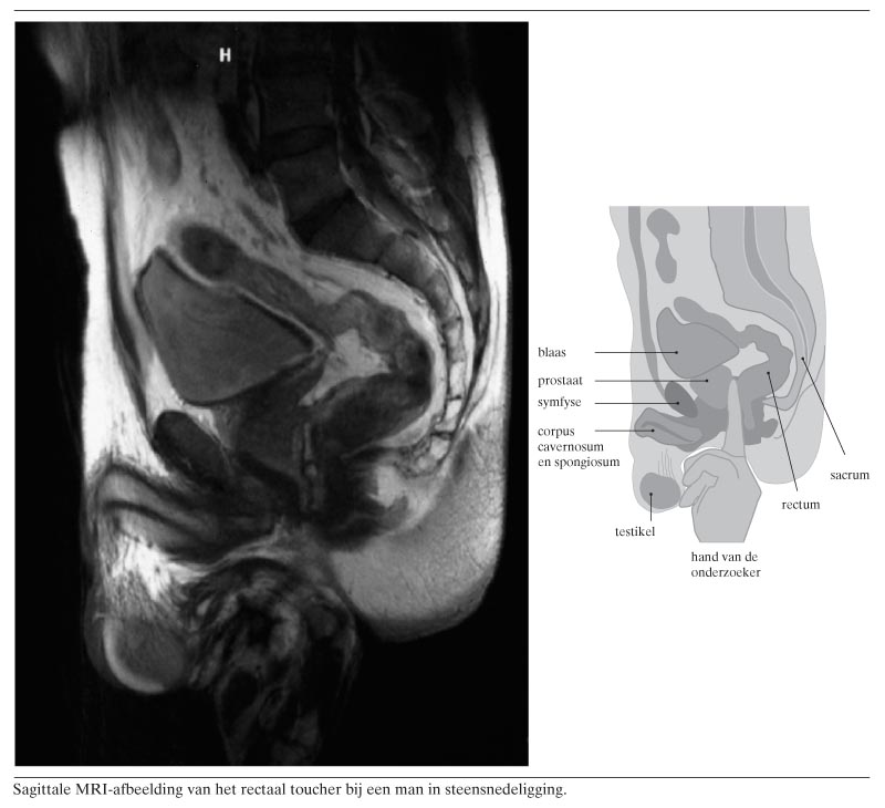 Fysische diagnostiek - rectaal toucher | NTVG