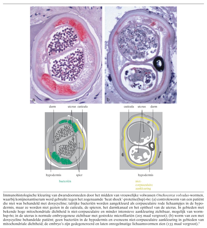 Rivierblindheid bestrijden door chemotherapie gericht op de ...
