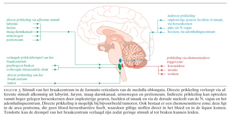 Braken als eerste neurologische symptoom van een hersentumor op de ...