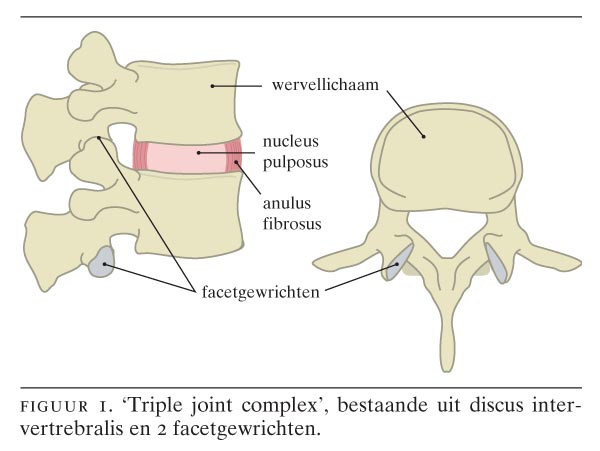 De discusprothese: mythen en feiten | Nederlands Tijdschrift voor ...