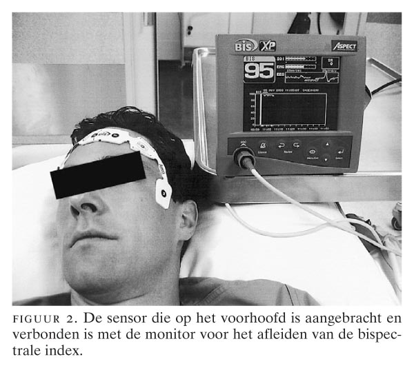 Bispectraalanalyse van het elektro-encefalogram: een nieuwe methode van ...